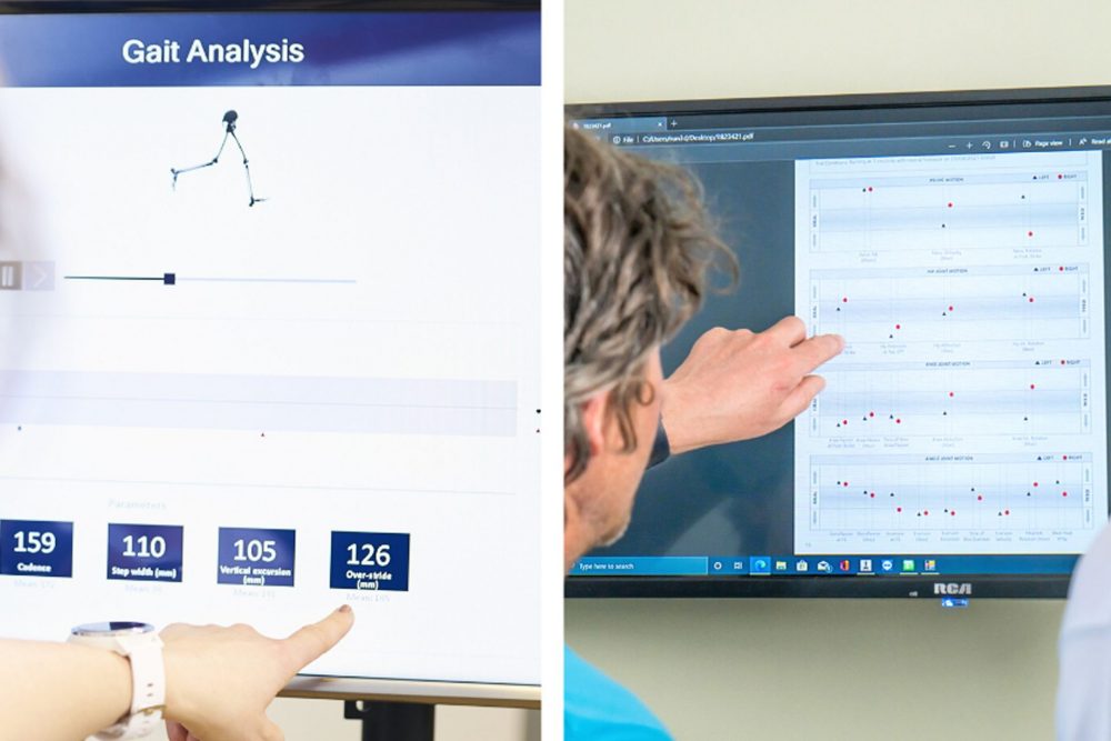 Orthotics & Gait Analysis to Improve Foot Function | The Foot Practice
