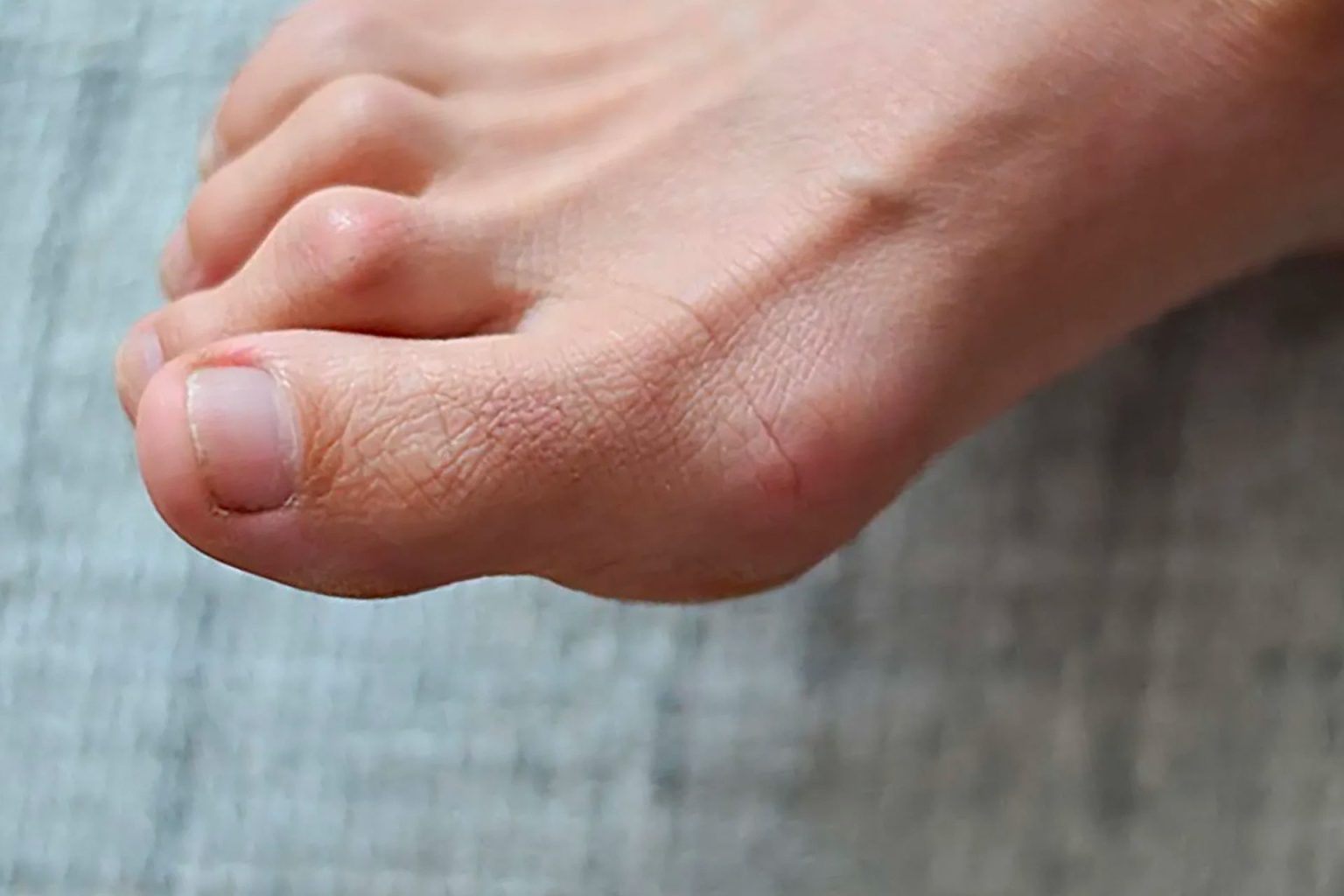 Relieve Pain on Outside of Foot: How Podiatry Helps