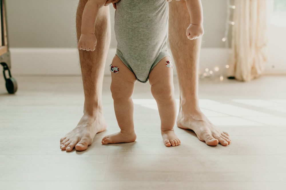 Podiatric Interventions for Hypermobility: Strength, Orthoses and Gait ...