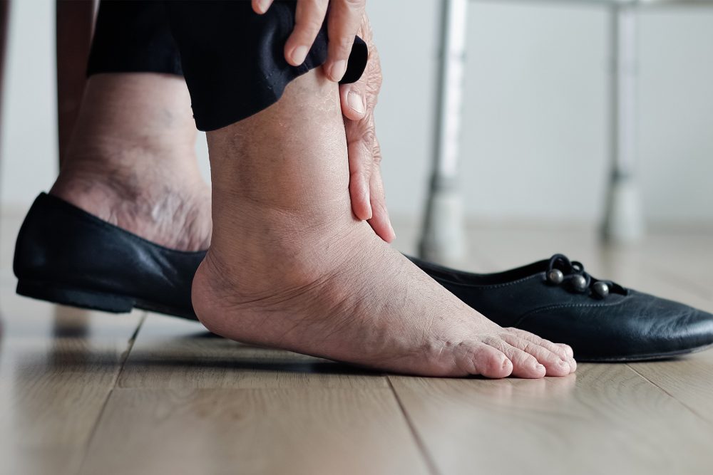 Total Contact Diabetic Insoles | The Foot Practice's Custom Insoles