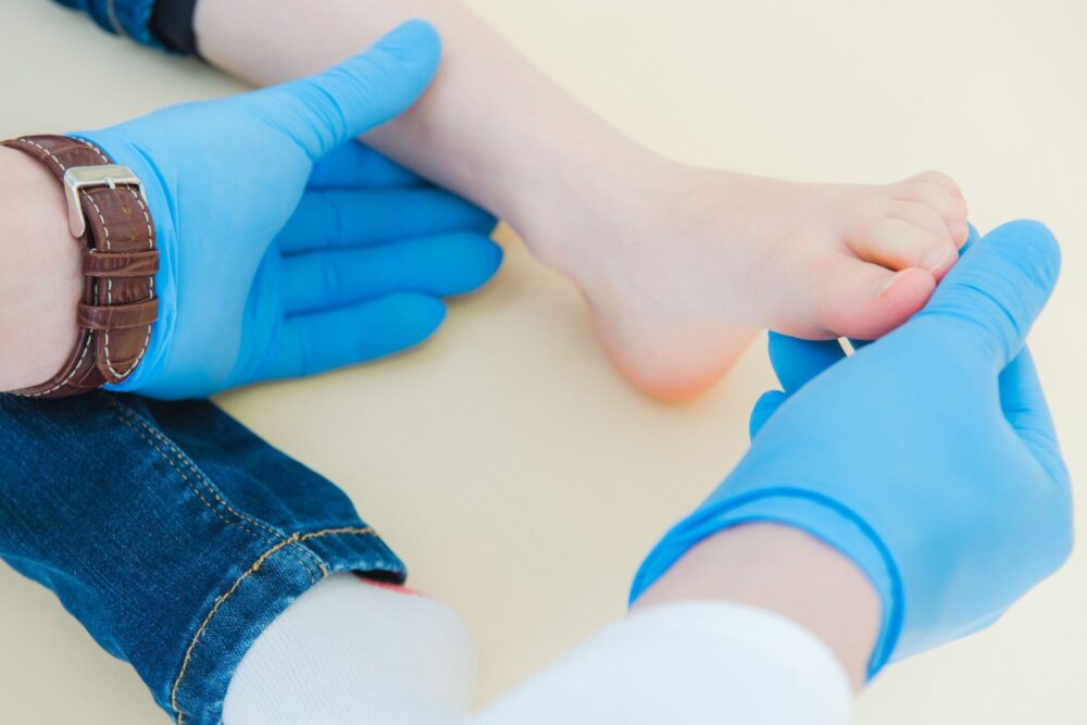 Podiatric Care for Paediatric Hammertoes