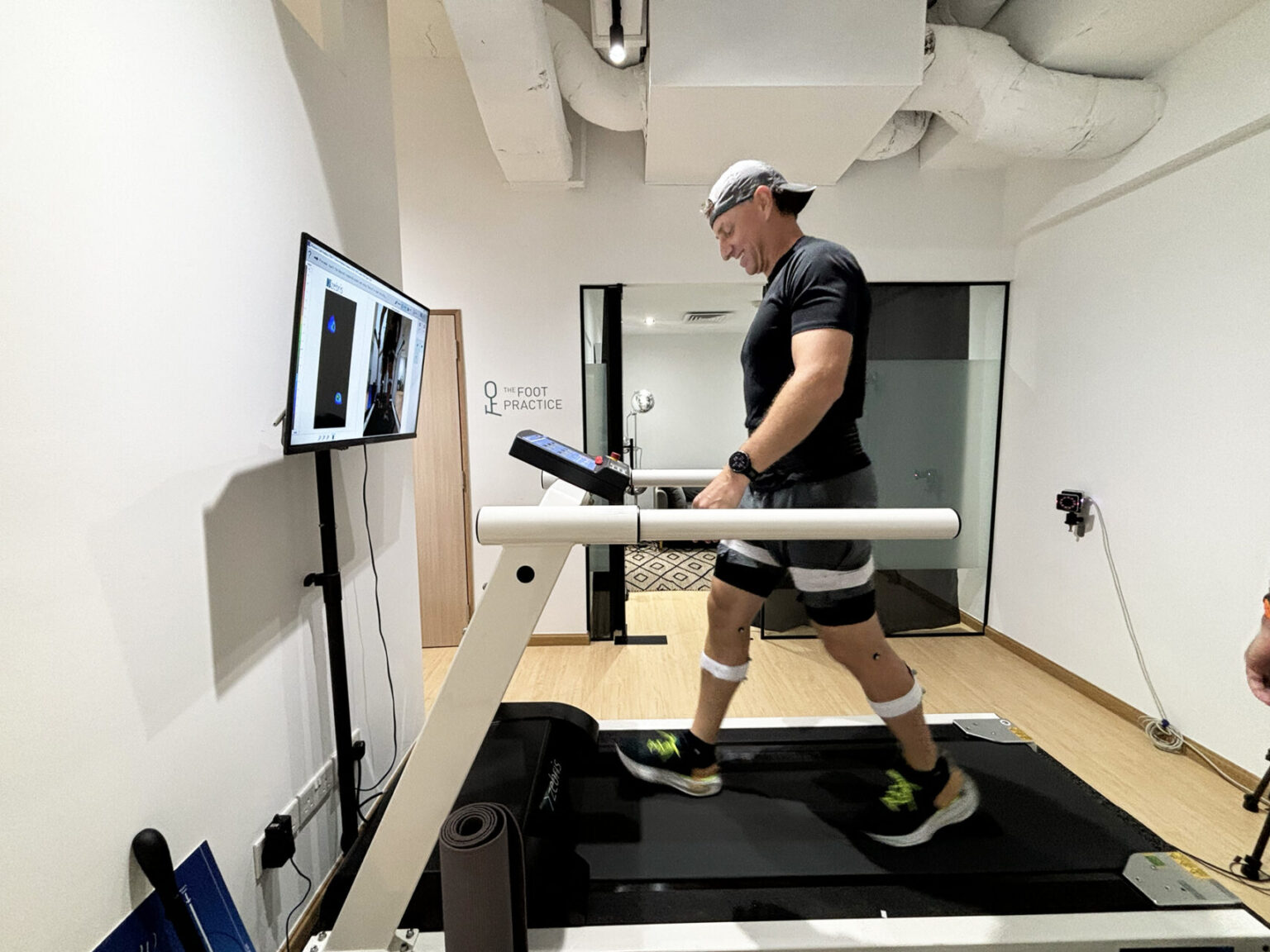 Orthoses for Morton's Neuroma: Addressing Root Causes Through Gait Analysis