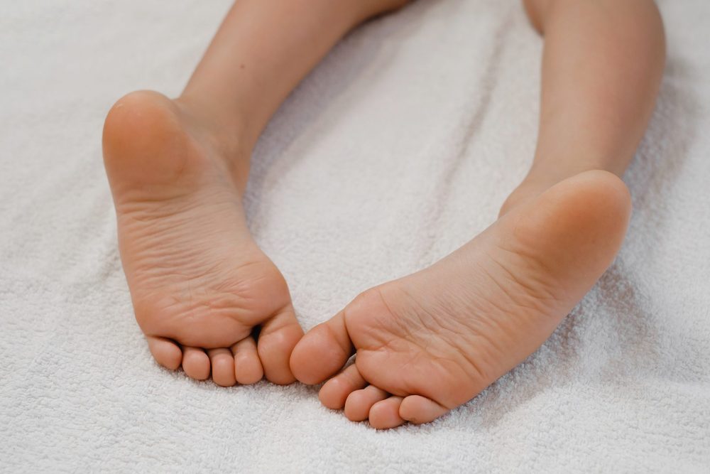 Intoeing in Children | The Foot Practice Paediatric Podiatry Singapore