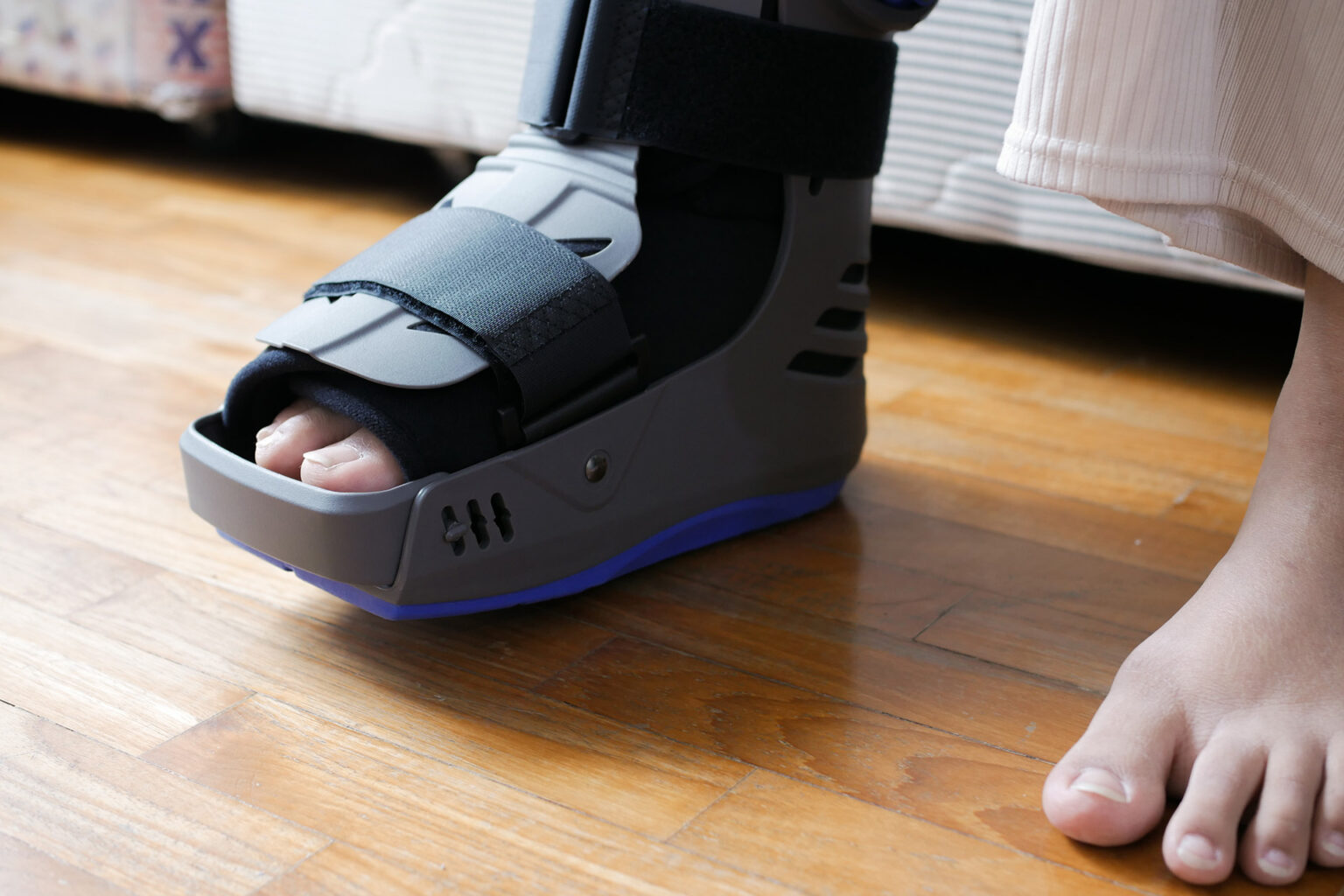 Stress Fractures in Children: Detection, Management, and Long-Term ...