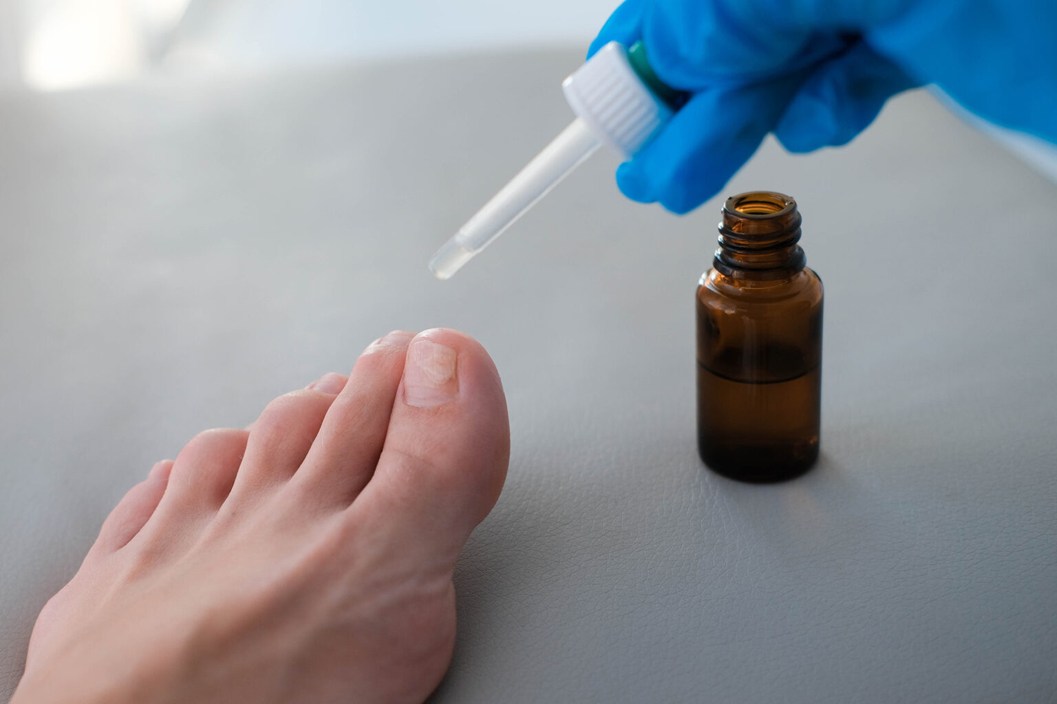 Paronychia Symptom, Causes and Podiatric Treatment