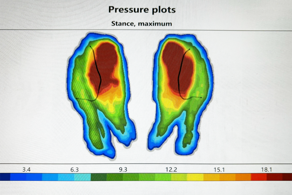 Sports Podiatrist Recommendations for Running Stress Fractures
