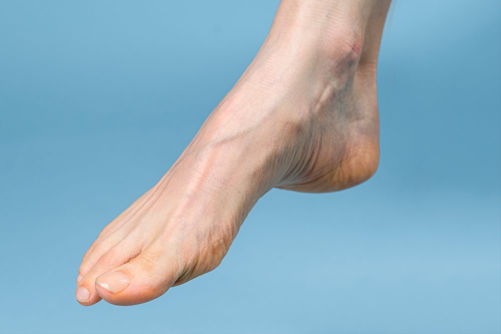 Talar Dome Injury Management | The Foot Practice Singapore