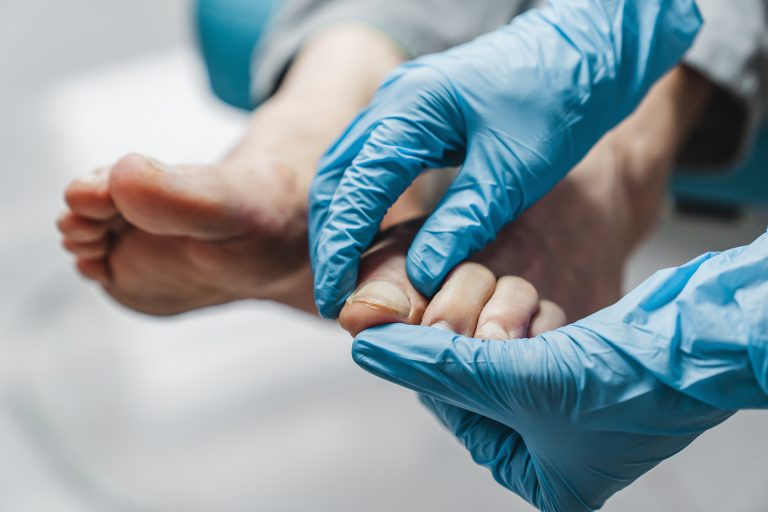 Turf Toe Injury Recovery | The Foot Practice Podiatry Singapore